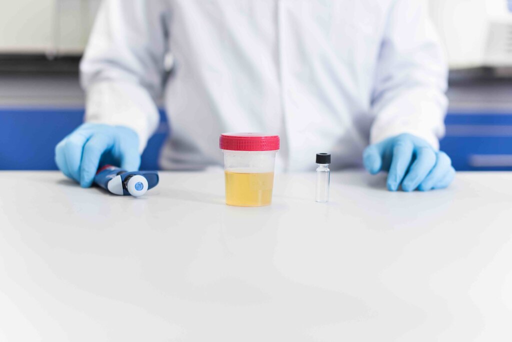Pre-Employment Urine Drug Testing for Safer Workplaces